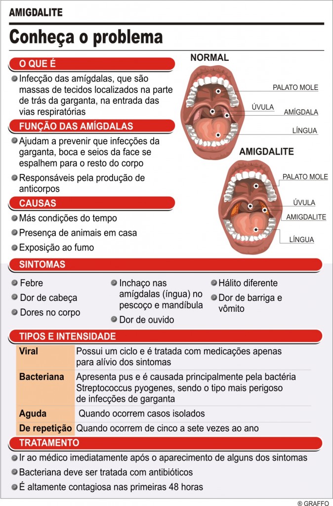 Dor de garganta pode ser um dos sinais de amigdalite - Vvale